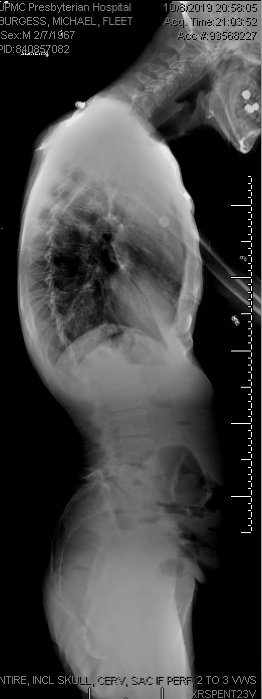 Sagittal Spine Segmentation Semantic Segmentation Dataset by Surreality Lab