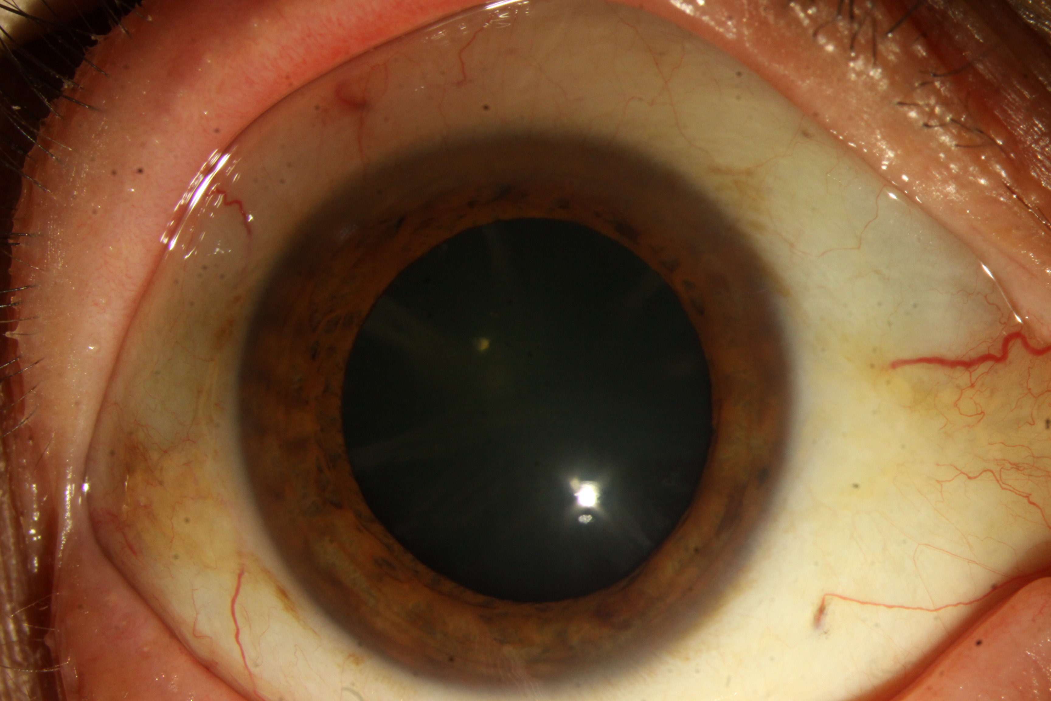 Iris Recognition Object Detection Model by University of Mumbai