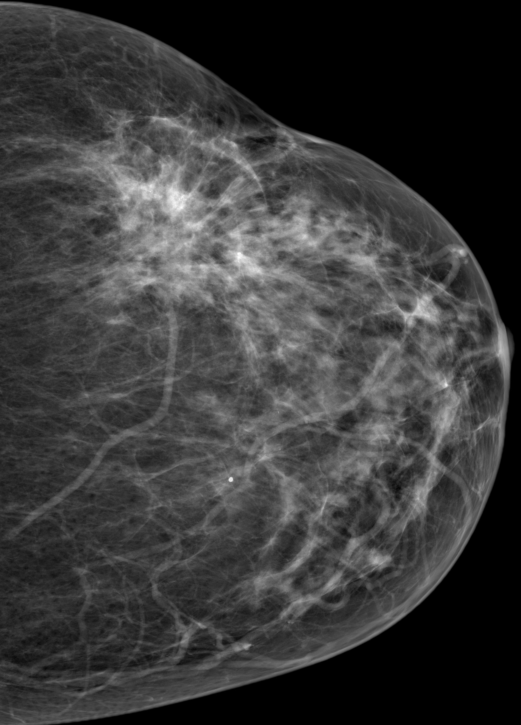 Breast Cancer Instance Segmentation Dataset by Work