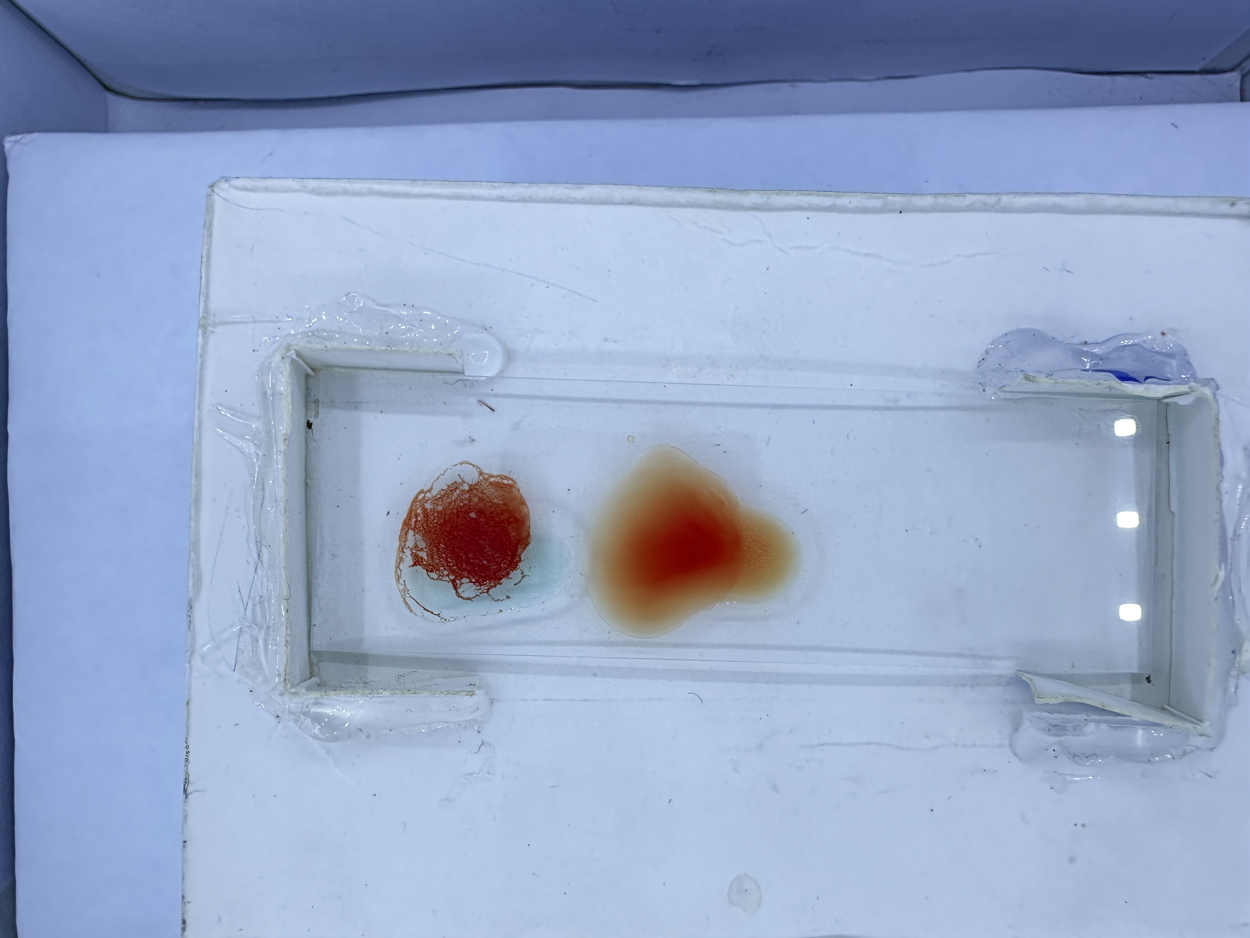 Blood Group Object Detection Dataset by ainsquared