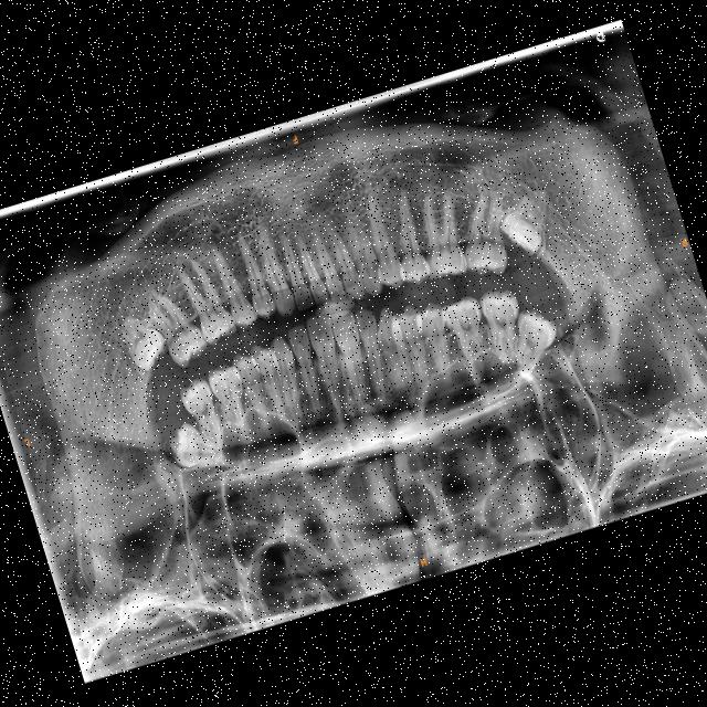 teeth Object Detection Dataset and Pre-Trained Model by ibrahim Biner