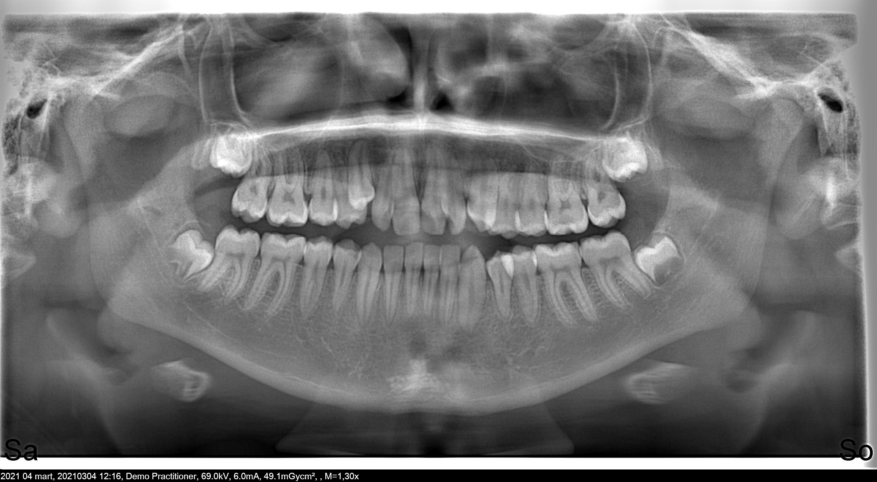 ttth Object Detection Model by Arshs Workspace21
