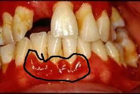 Arshs Workspace21 Roboflow Universe