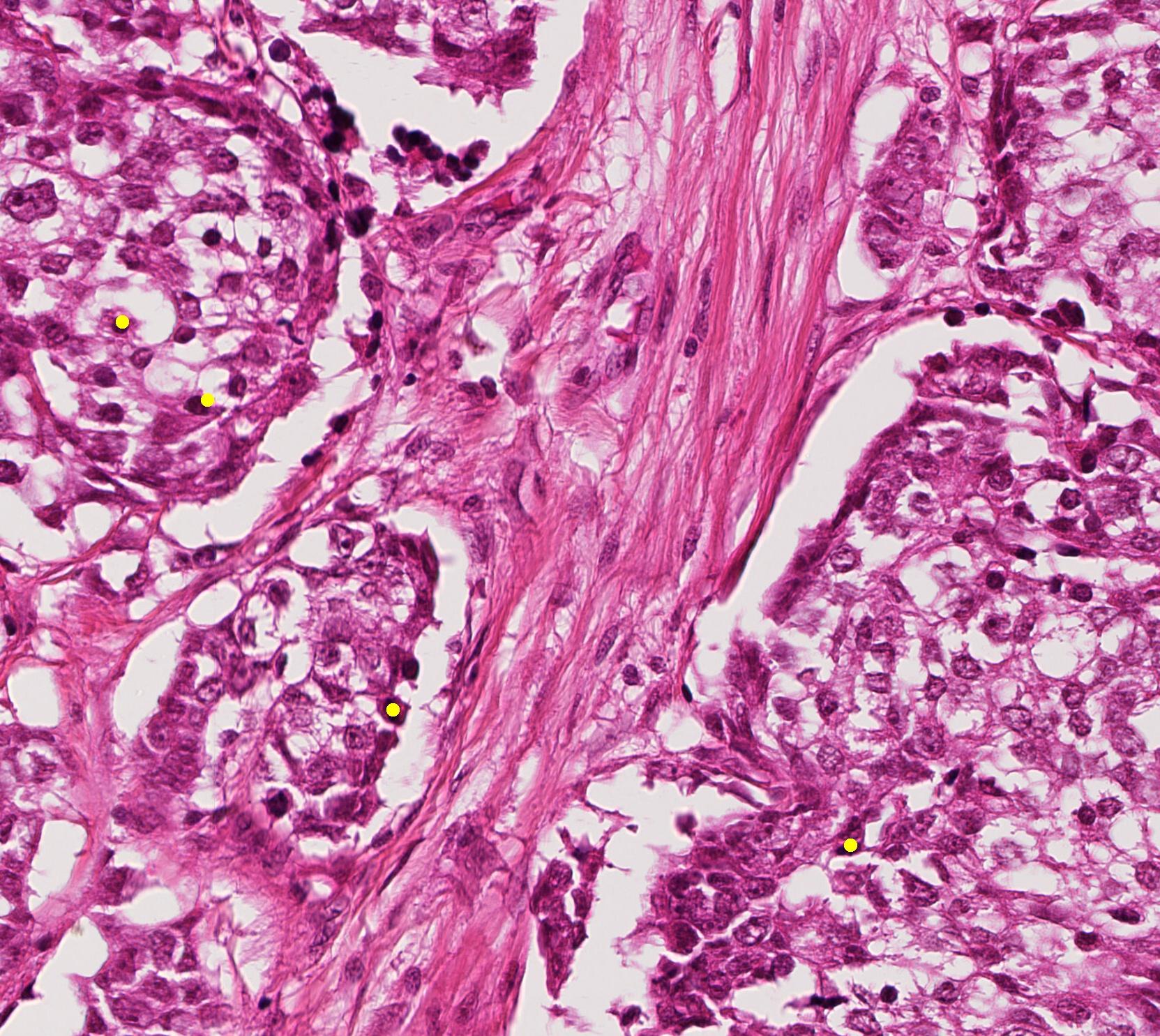 Not Mitosis Detection Object Detection Dataset By Hifza