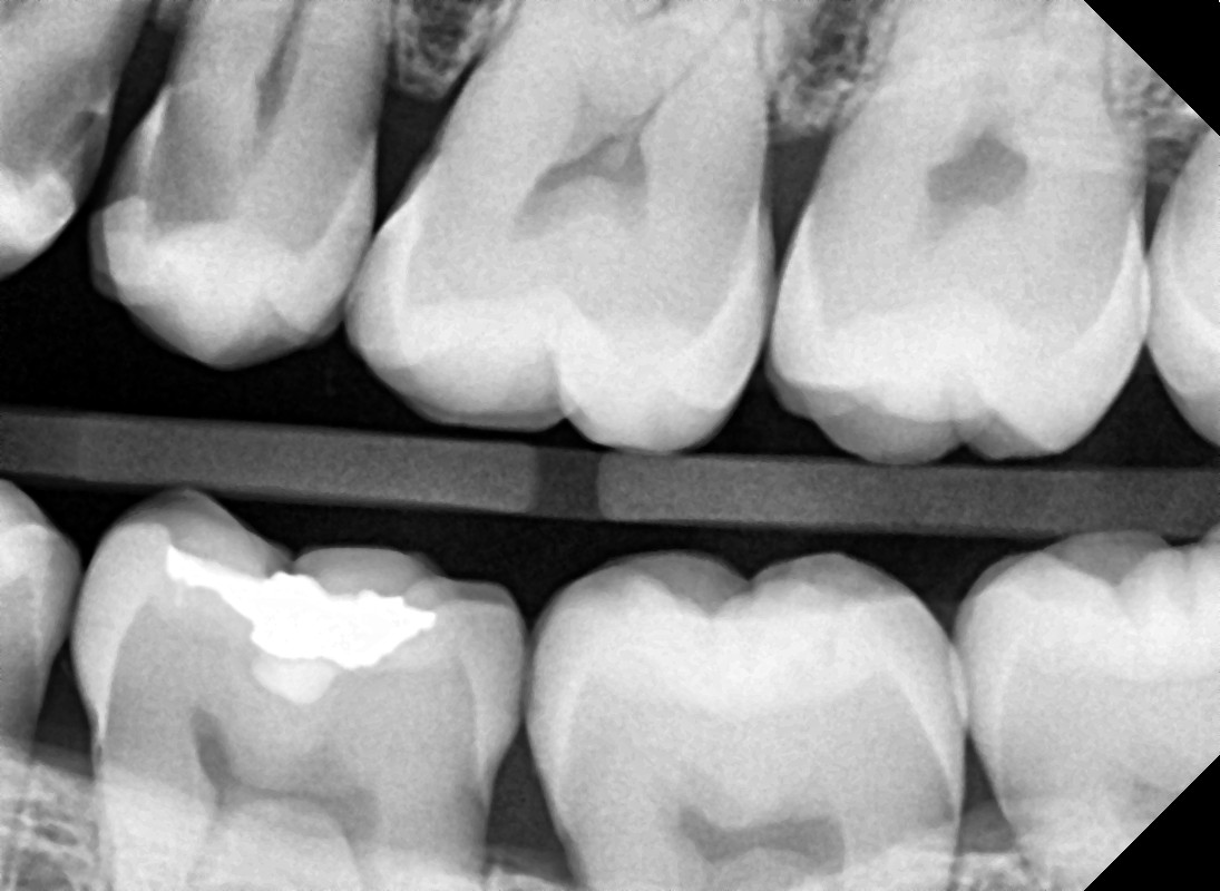 Fit Instance Segmentation Model by Trial