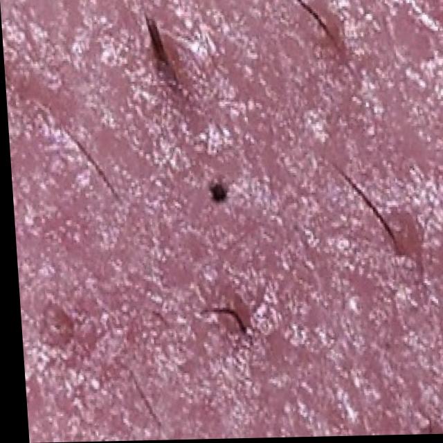 SKIN_CONCERNS Object Detection Model by Reezen