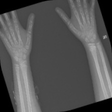 Bone-Fracture Object Detection Dataset and Pre-Trained Model by UET TAXILA