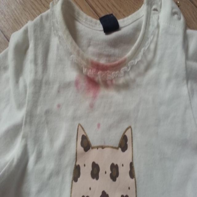 stain_detection Object Detection Dataset and Pre-Trained Model by ...