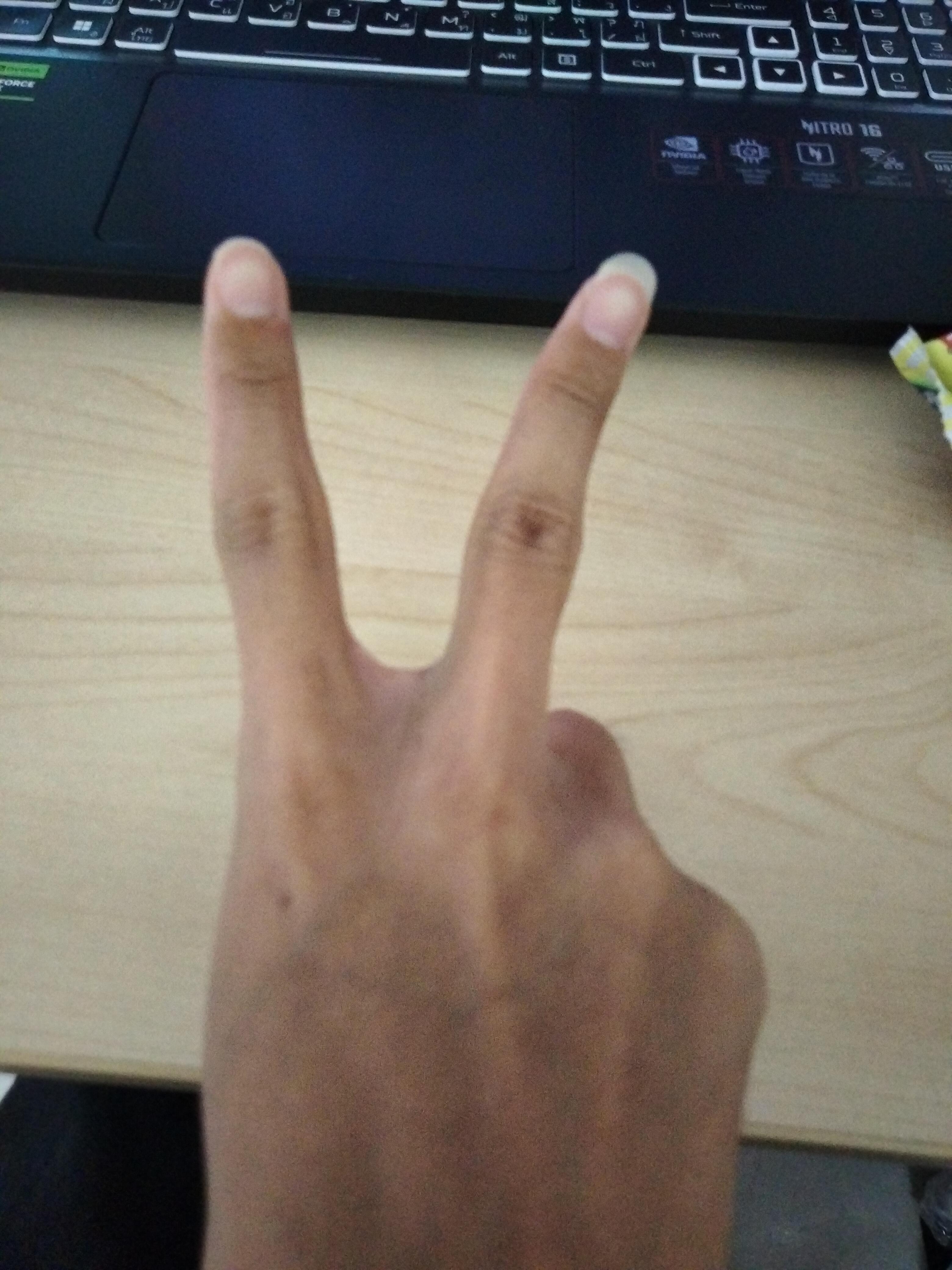 Hand Detection Object Detection Model By Kku Ai Camp