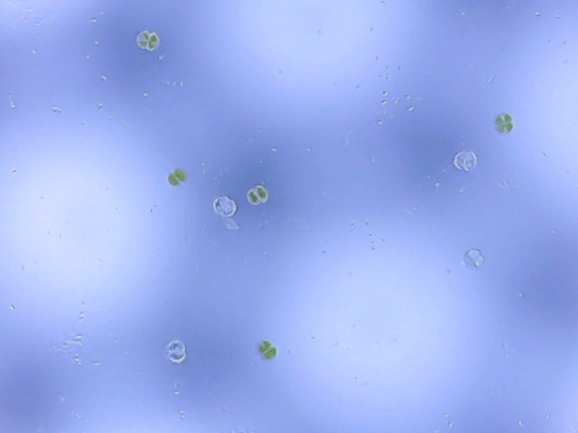 Algae Detection Object Detection Dataset by GMT