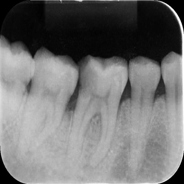 iopa - Roboflow Universe