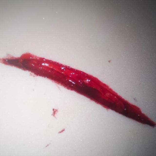 Wound detection Object Detection Dataset and Pre-Trained Model by ...