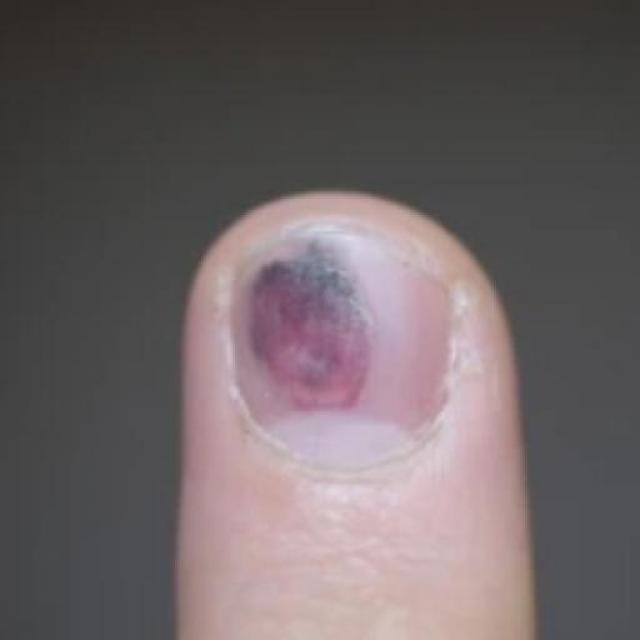 jhjh Classification Dataset by vnrvjiet