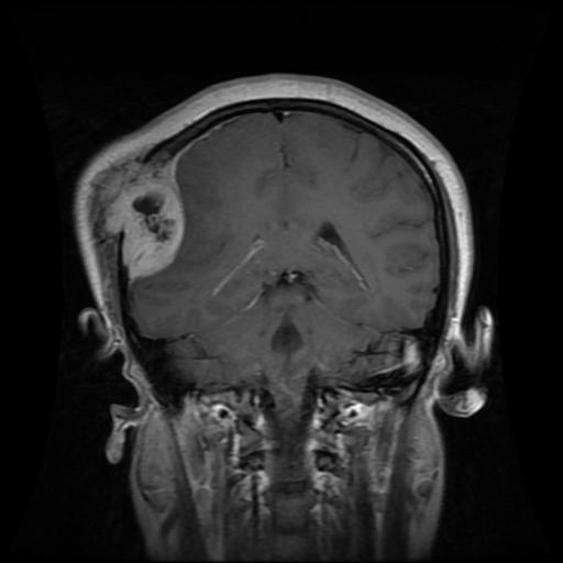 Brain Tumor Detection Object Detection Dataset by nishanth