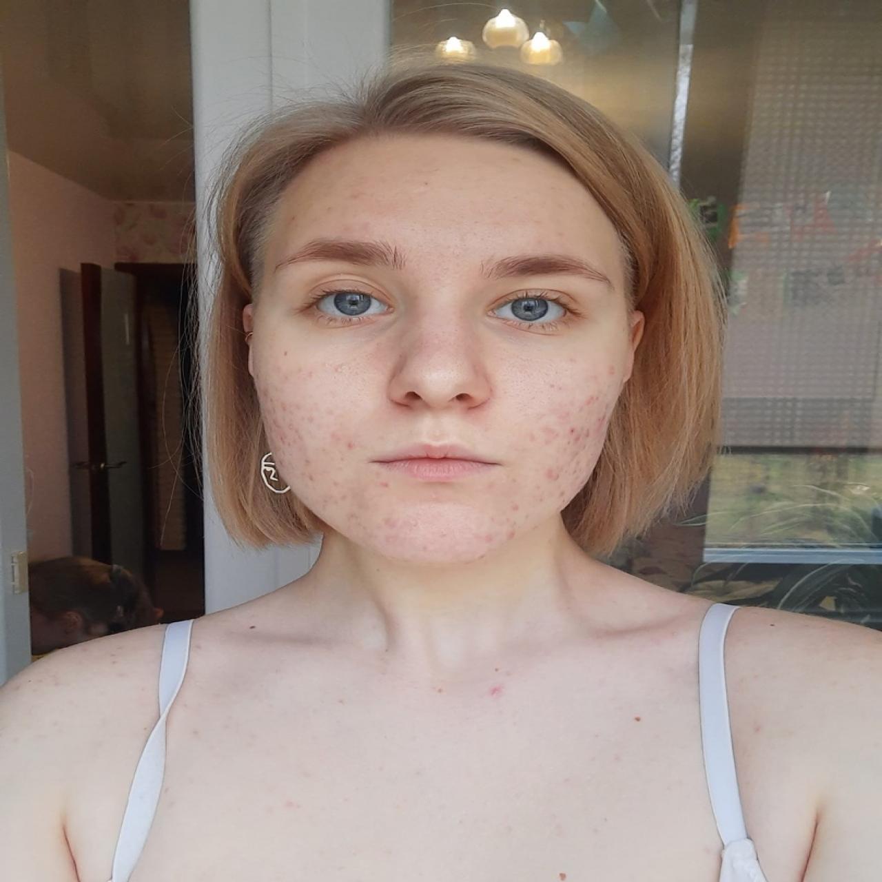 spot_detector Object Detection Model by PRJs