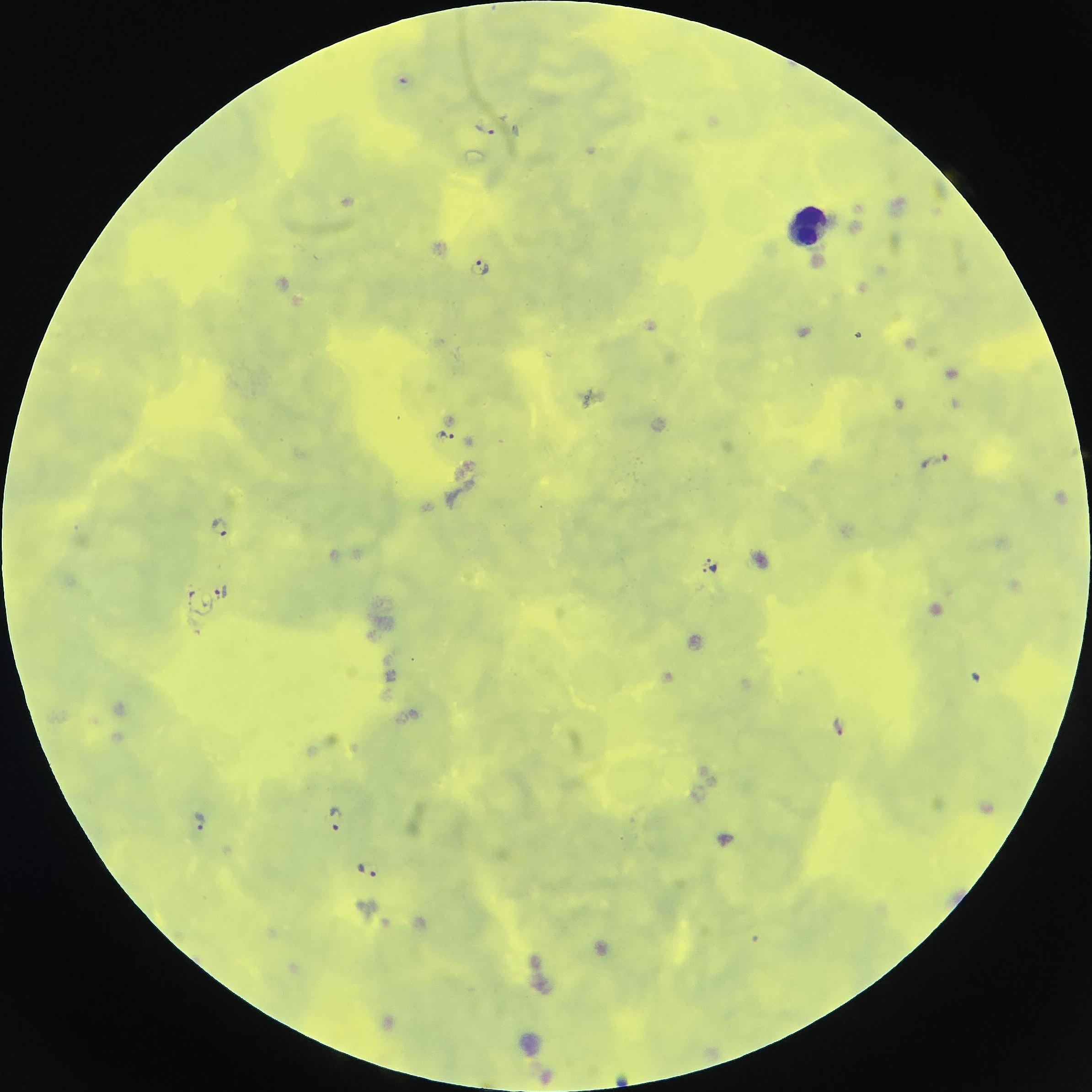 MalarIA Object Detection Dataset by Bill Bardales