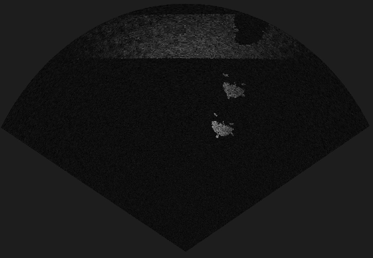 Mine_sonar_images Object Detection Dataset by Phan Quang Tuan