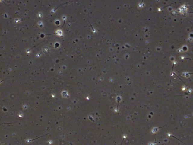 How to Use the Sperm Motion Detection Object Detection API