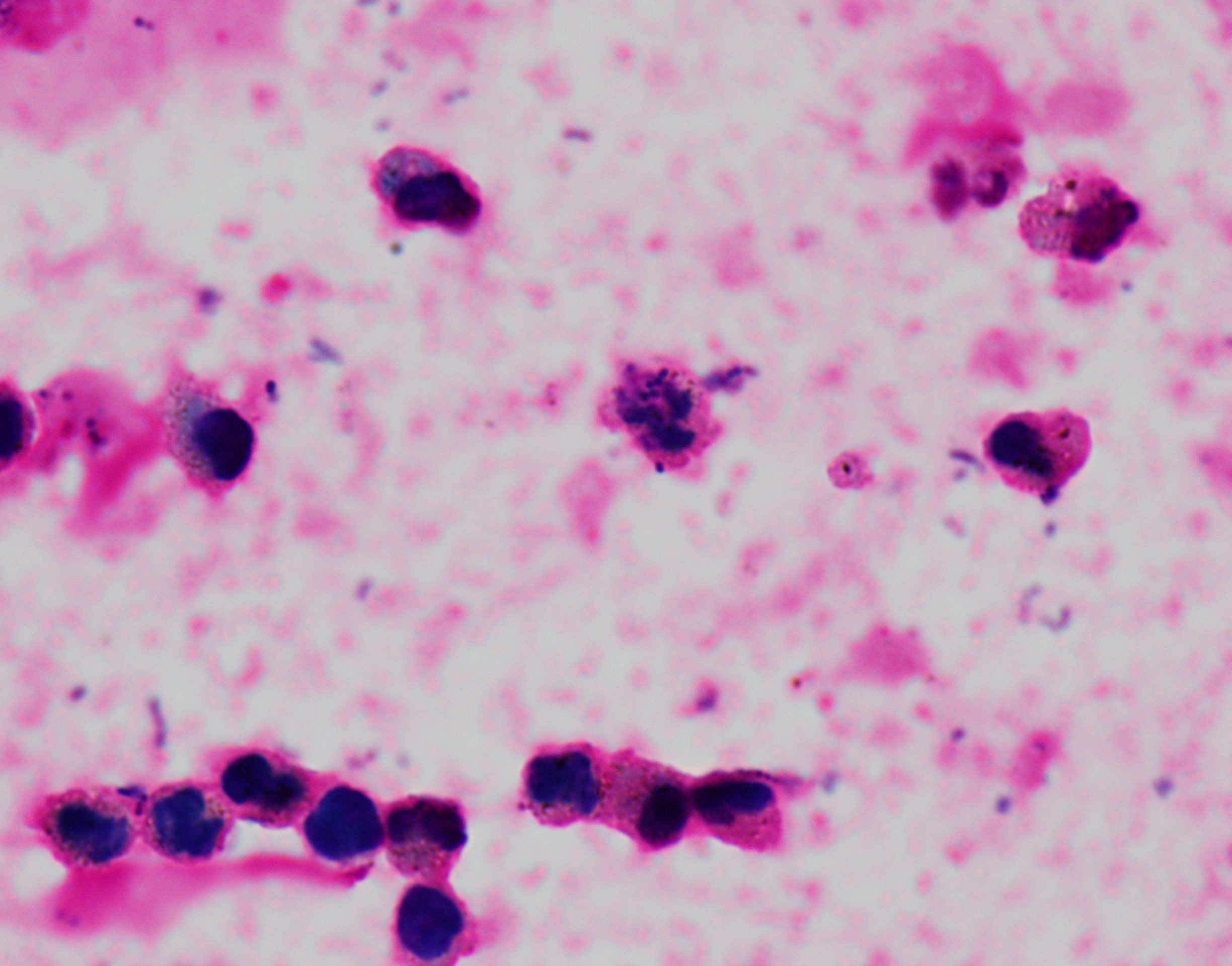 WBC Object Detection Dataset and Pre-Trained Model by aspace