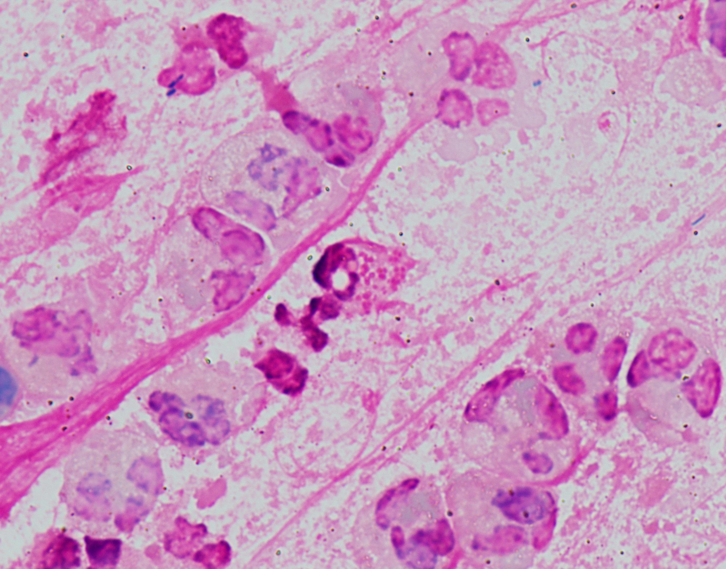 newbc2 Object Detection Dataset by aspace