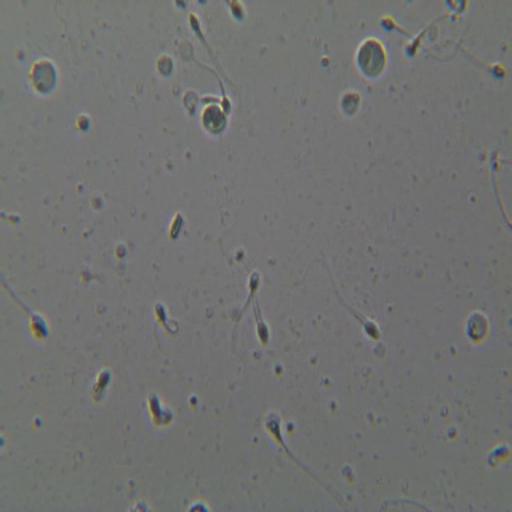 Sperm cells detection Object Detection Model by Beez Biotech