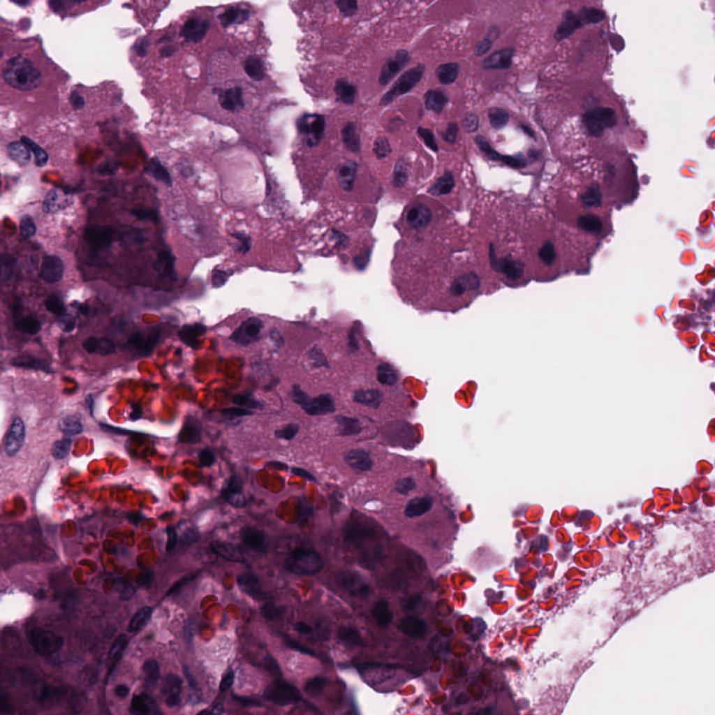 Celldetect Object Detection Dataset And Pre Trained Model By Ocelot