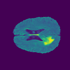project_brain Object Detection Dataset and Pre-Trained Model by ...