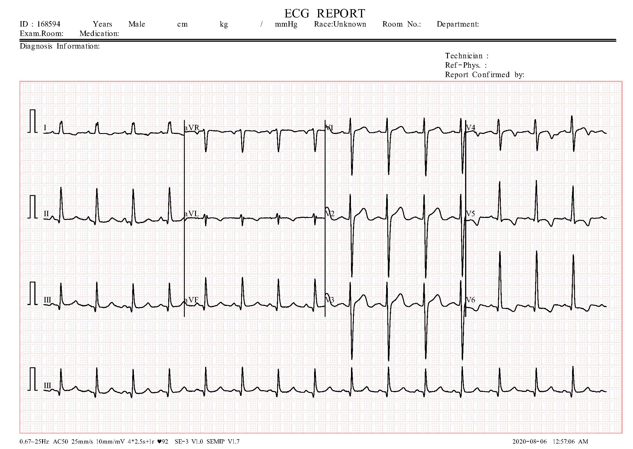 Heart_ECG_labelling Classification Dataset by vehicle detection