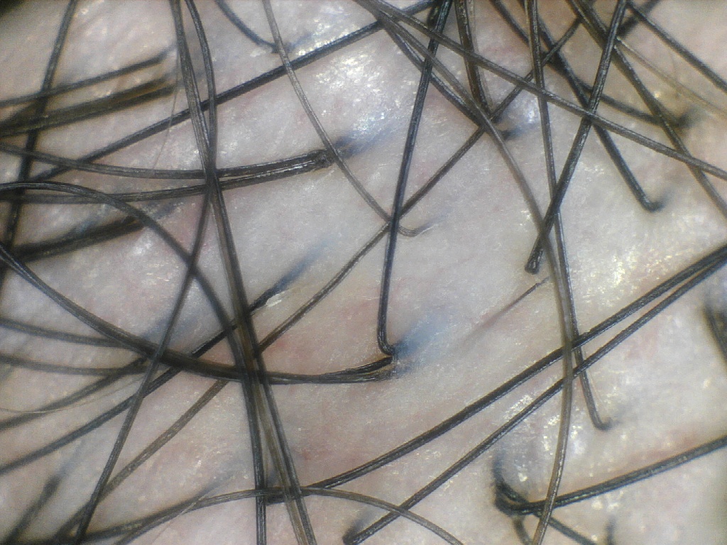 Hair Detection Model Object Detection Dataset By H