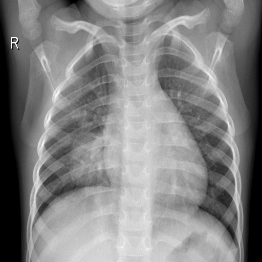 lungs-class Classification Dataset and Pre-Trained Model by lungscls
