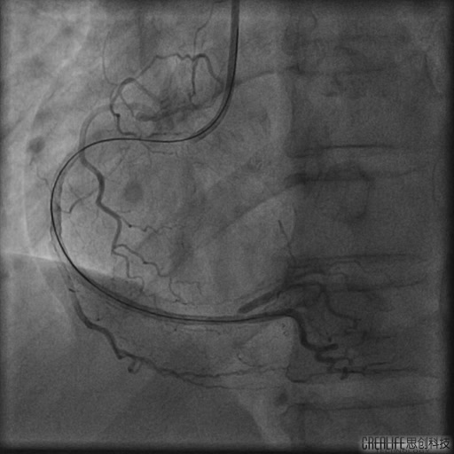 Guidewire Endpoint Localization Object Detection Dataset by Guidewire