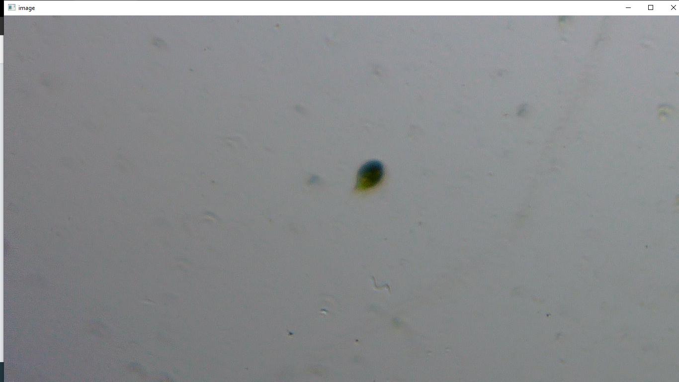 bacteria classification 2 Object Detection Model by BACTERIA DETECTION ...