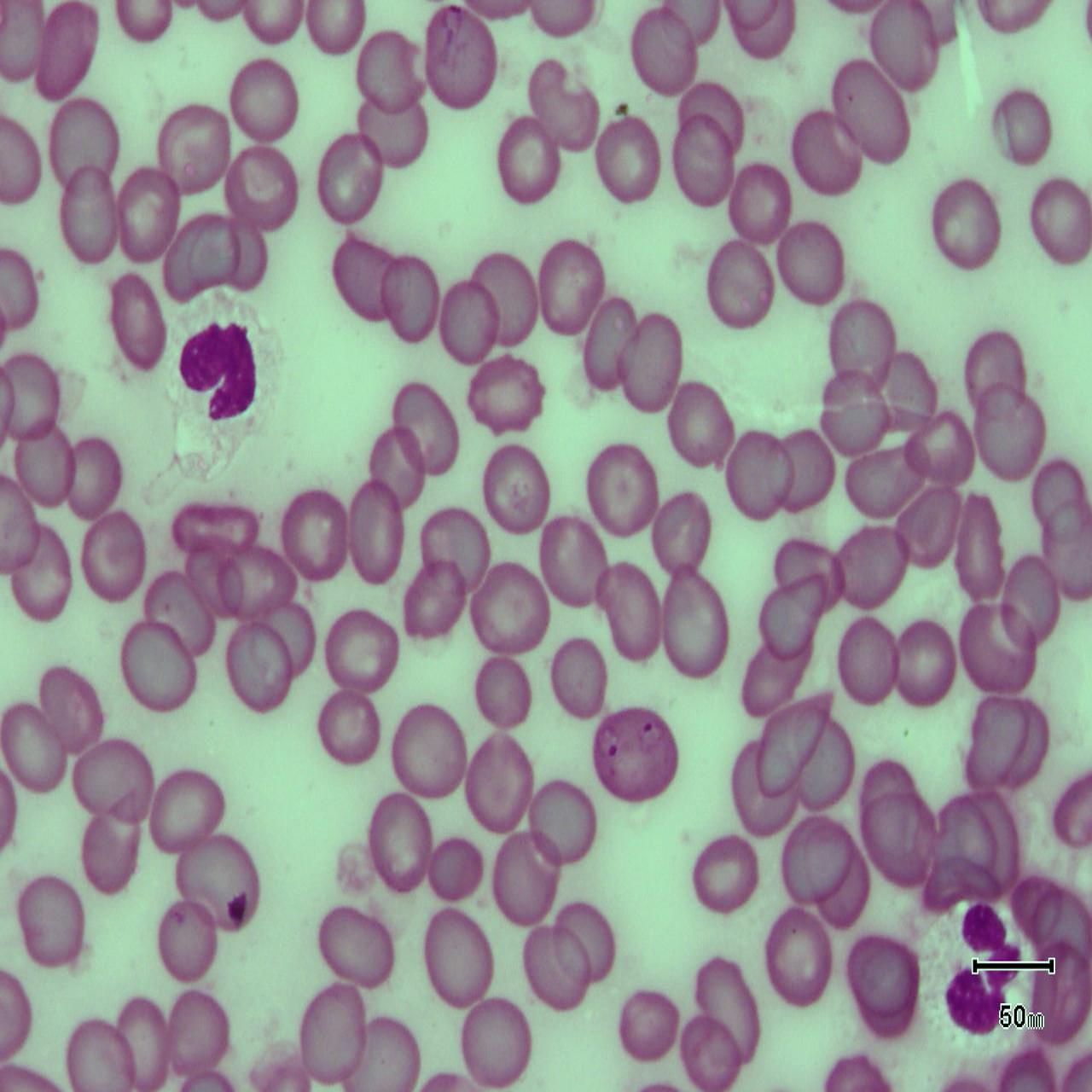 Parlciparum IML v2 Object Detection Dataset by Luca Zedda