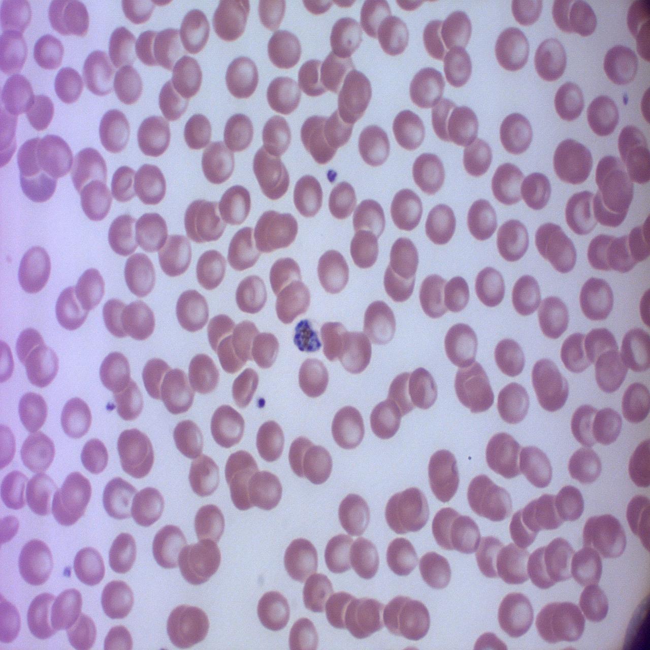 Malaria 2 Object Detection Dataset By Luca Zedda