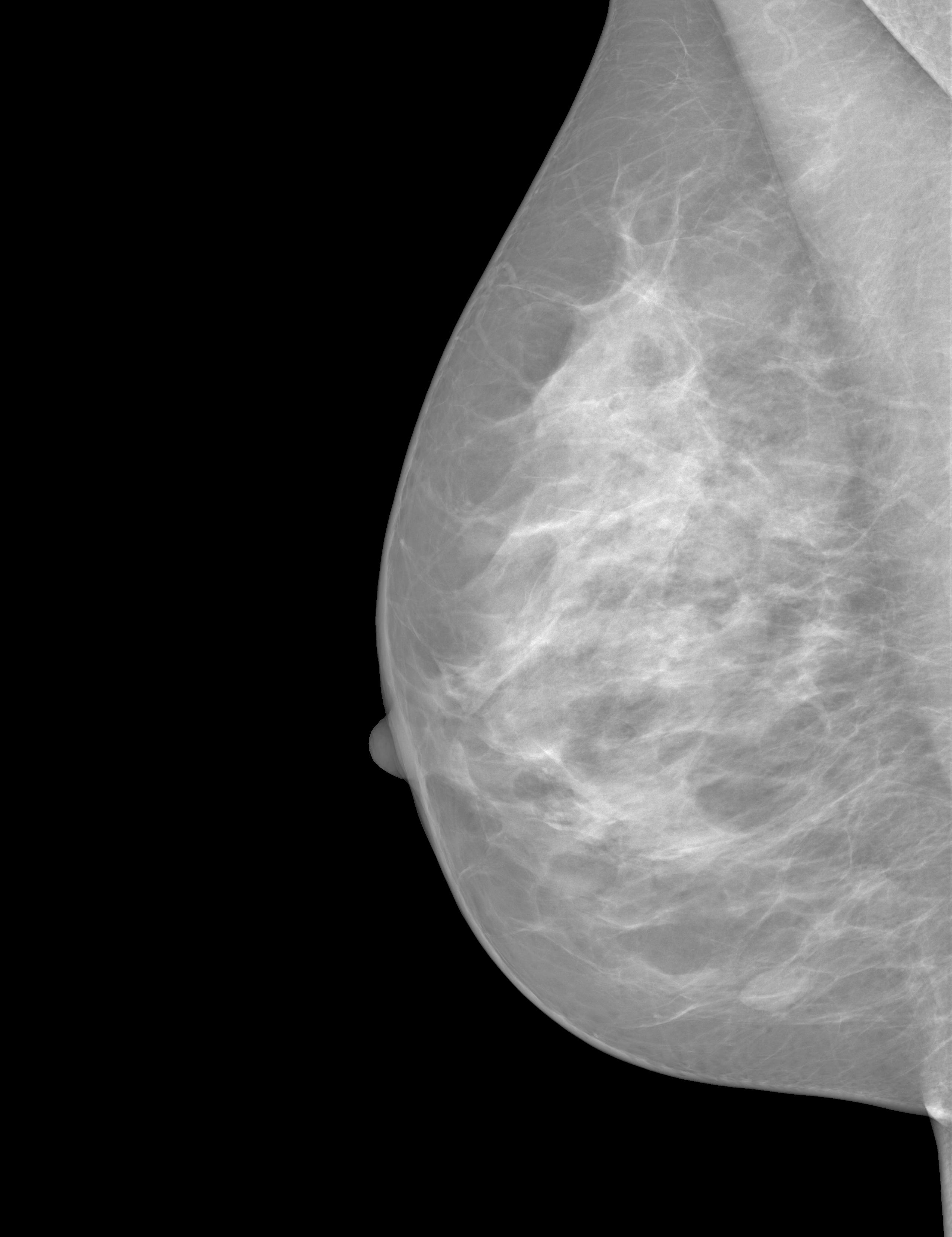 INbreast Dataset Object Detection Model by BreastSeg