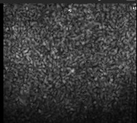 DWI BLEED DETECTION - Roboflow Universe