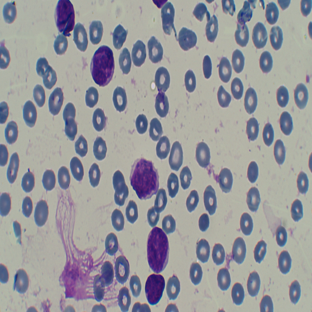 Leukemia Classification Object Detection Dataset by Leukemia