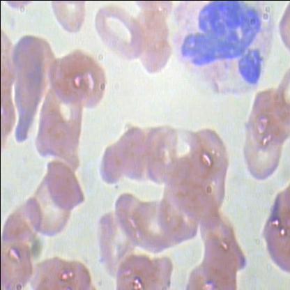 Blood cell detection Object Detection Dataset and Pre-Trained Model by ...