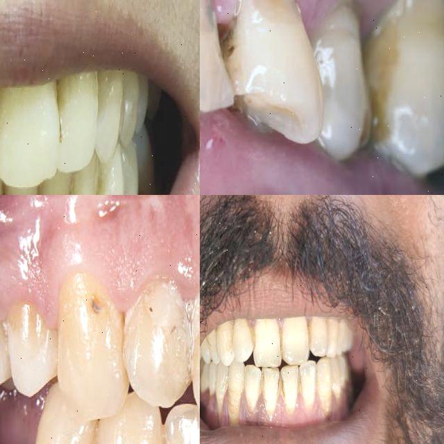 Kalkulus Object Detection Dataset by yoga