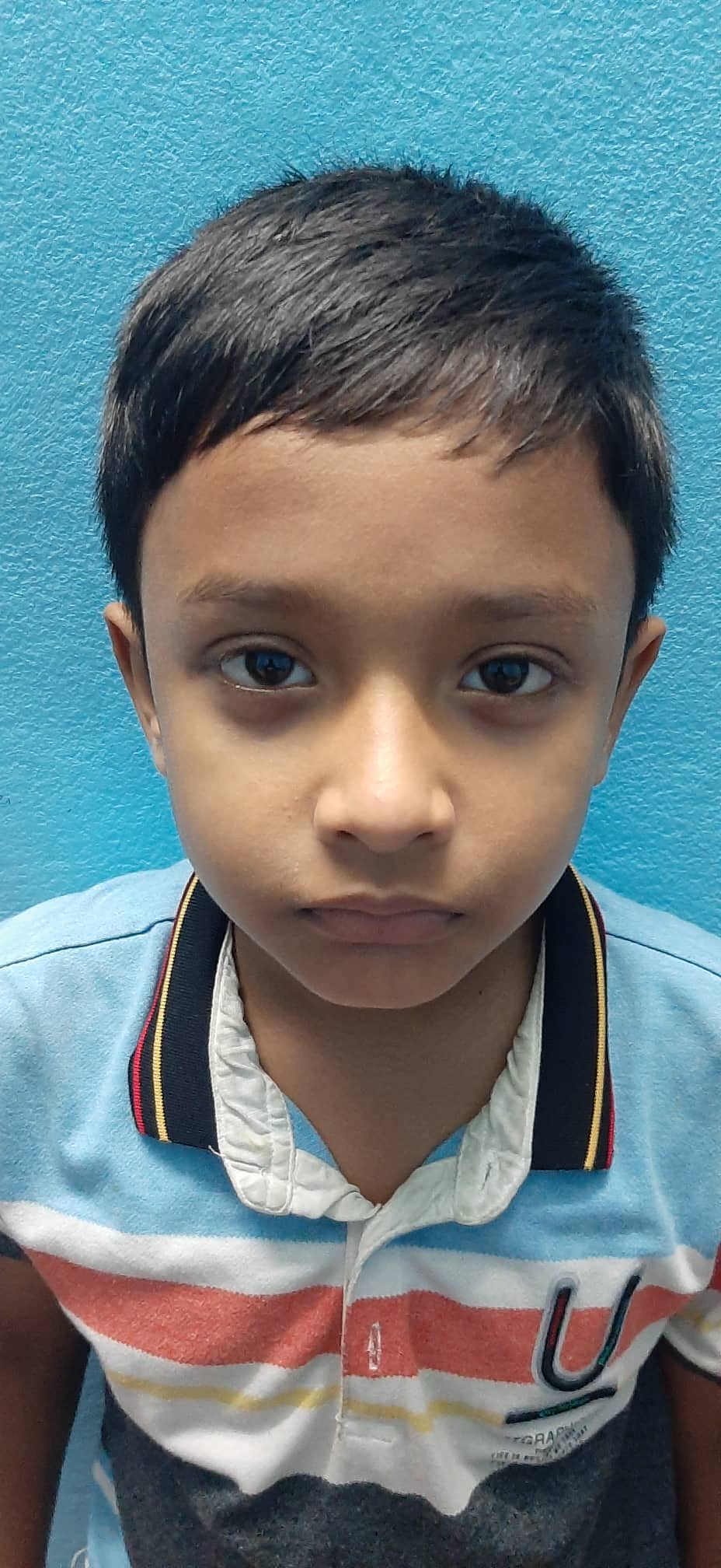 Monkeypox Only Object Detection Dataset and Pre-Trained Model by Monkeypox