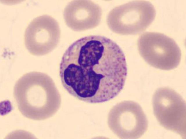 Blood Cells Detection Object Detection Dataset by datasets