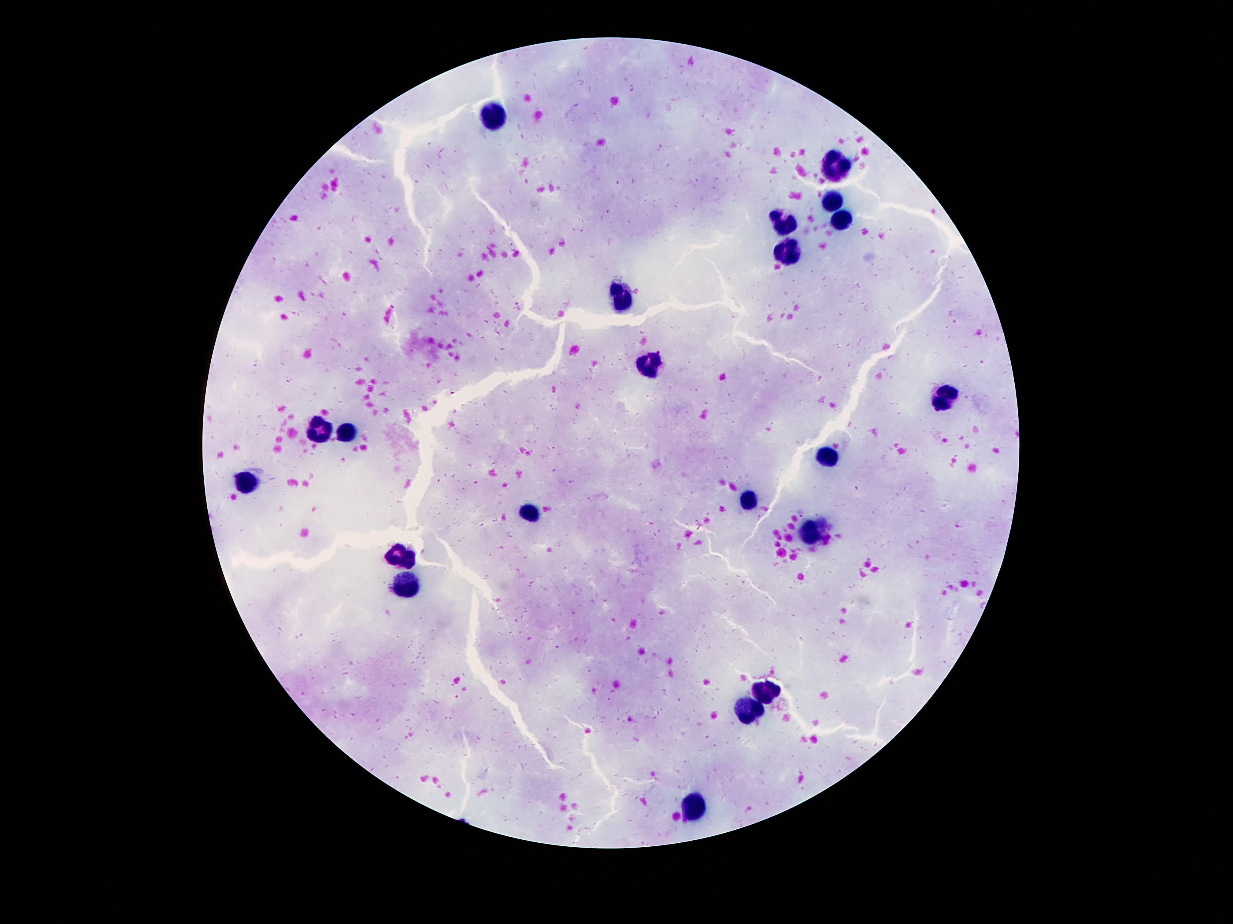 parasited rbc (parasited-rbc-44mv8) - Roboflow Universe