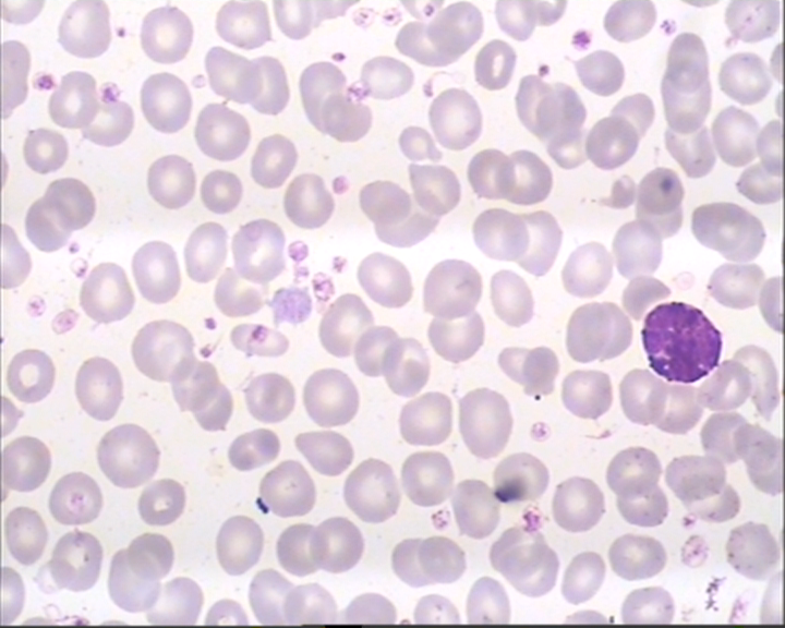 Dengue Dataset Object Detection Dataset By Hima