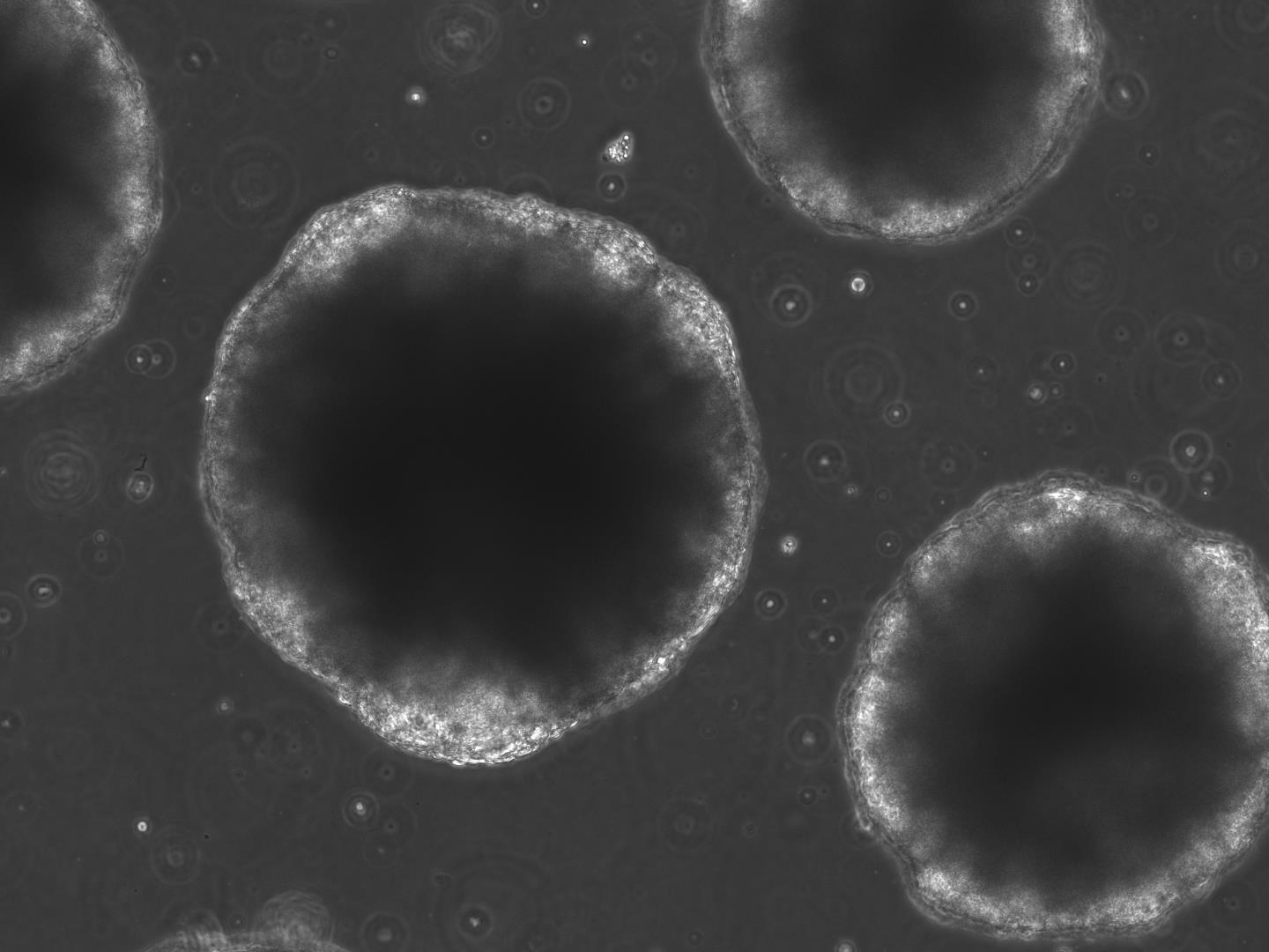 Heart Organoids Instance Segmentation Model by Vu Mai Anh