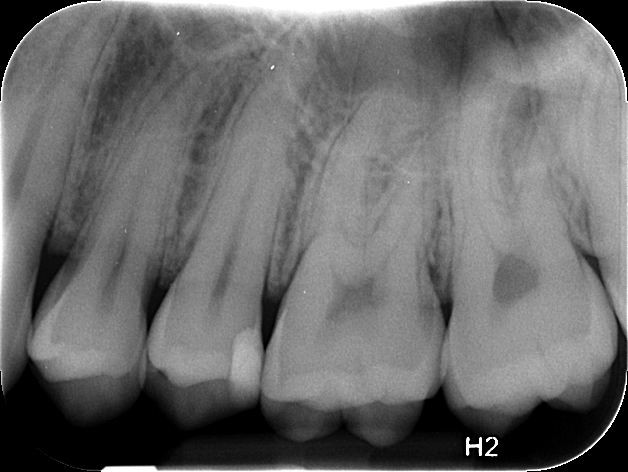 Single-R Instance Segmentation Dataset by Sample