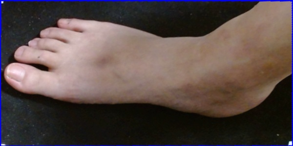 Foot Keypoint Object Detection Dataset And Pre Trained Model By Foot