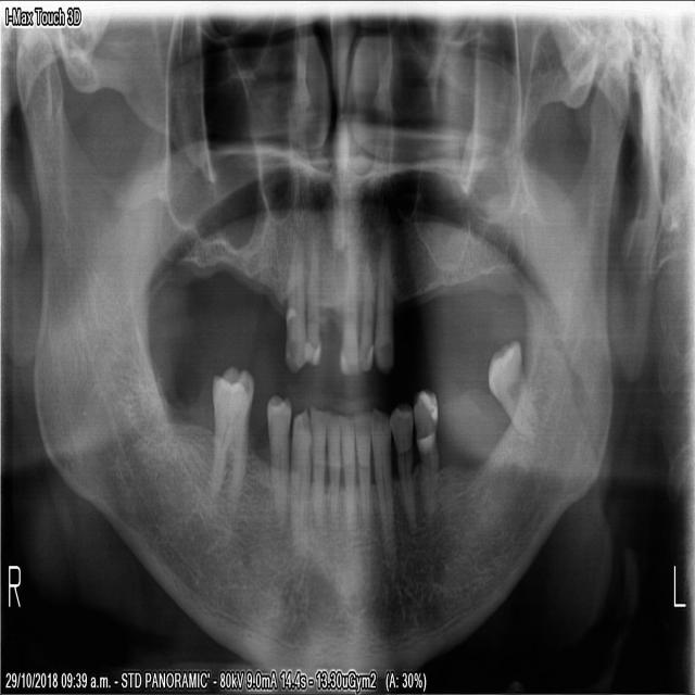 dental Object Detection Dataset and Pre-Trained Model by sample