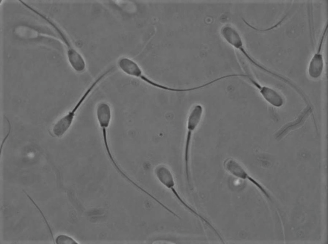 sperm-stage2 Object Detection Dataset by Ghamgui Amine