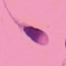 sperm Object Detection Dataset by Ghamgui Amine