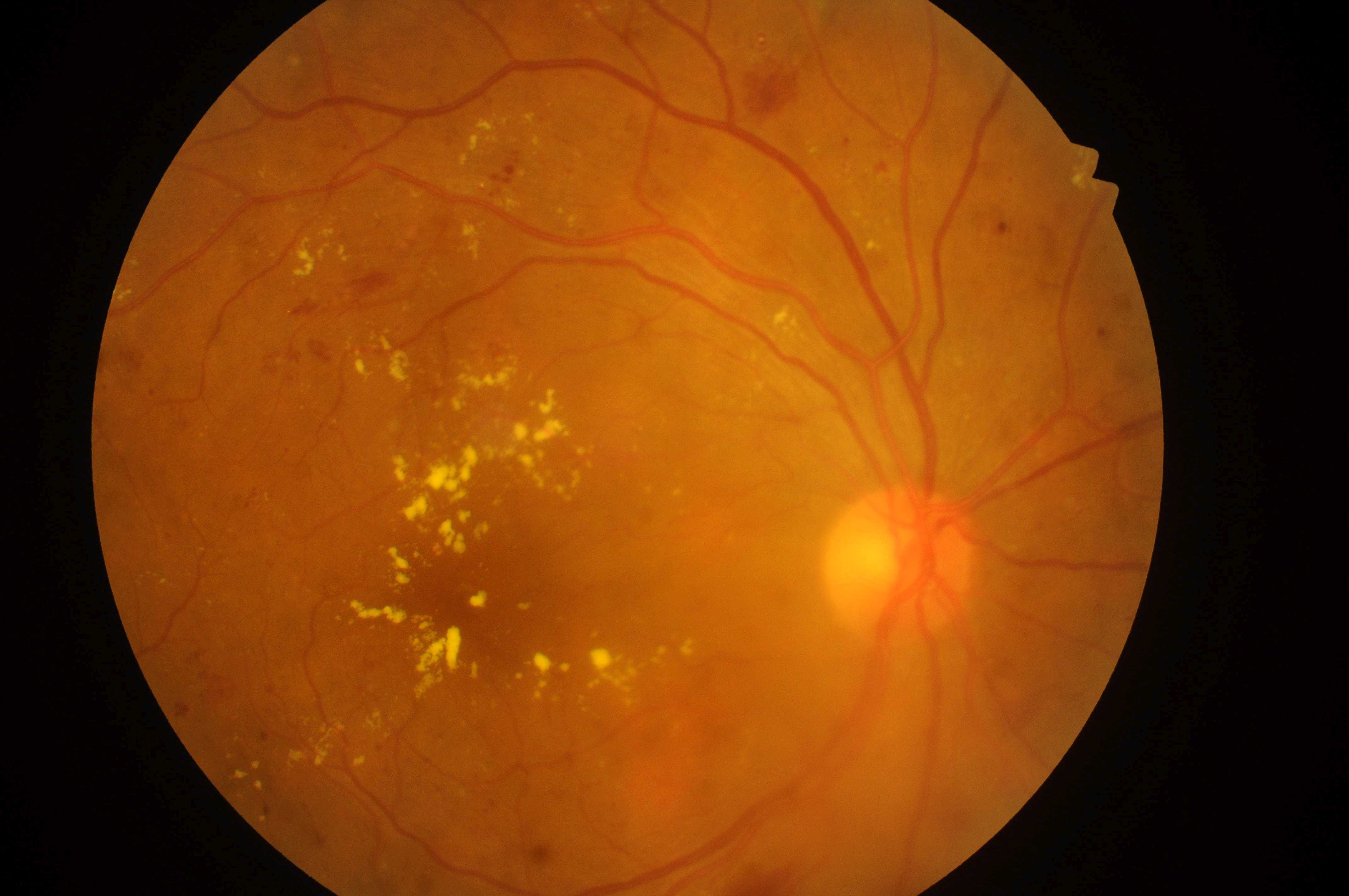 id Object Detection Model by eye